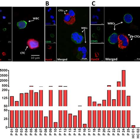 Isolation Of Circulating Tumor Cells Ctcs From Non Small Cell Lung