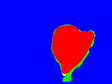 GitHub Coldplayl CVC An Segementation Propose For Medical Image