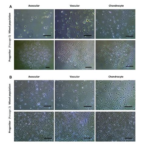 Comparison Of Progenitor Cells Morphologies Isolated From Meniscal And