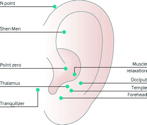 Auricular Acupuncture Headache At Connie Goodin Blog