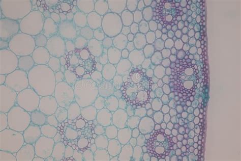 Cross Section Dicot Monocot And Root Of Plant Stem Under The Microscope Stock Photo Image Of