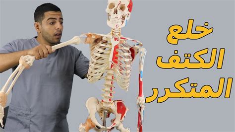 علاج خلع الكتف المتكرر بدون جراحههتحرك دراعك بدون خوف من الخلع وبدون