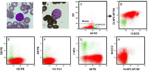 Morphological And Flow Cytometric Characterization Of Blasts From Case