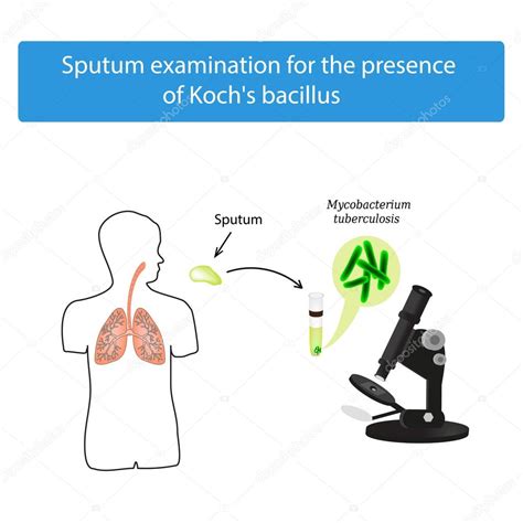 Sputum Examination World Tuberculosis Day Infographics Vector