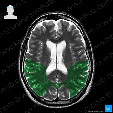 Brain Mri How To Read Mri Brain Scan Kenhub