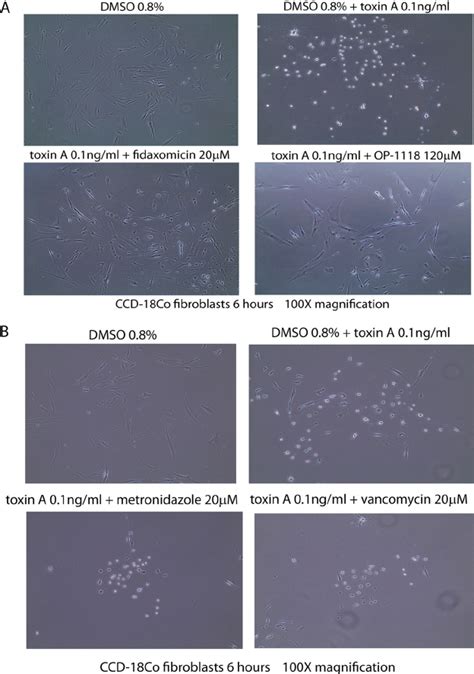 Fidaxomicin And Op 1118 Prevented C Difficile Toxin A Mediated Cell Download Scientific