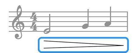 Free What Should A Musician Do If They See This Symbol When Playing A