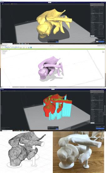 Formation Process Of A Model Showing Step By Step Preparation Of The Download Scientific