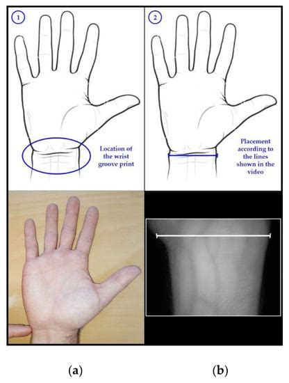 Sensors Free Full Text Wrist Vascular Biometric Recognition Using A