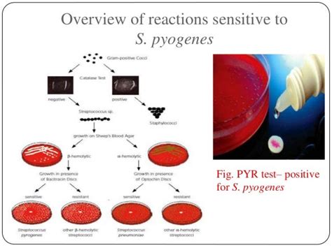 Streptococcus Pyogens