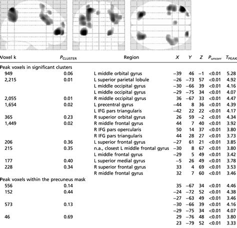 rapid and independent memory formation in the parietal cortex pnas