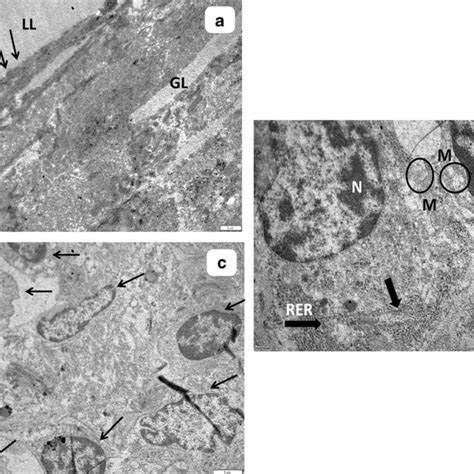 A Electron Micrograph Showing Eosinophil With Its Characteristic Intra Download Scientific