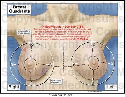 Breast Quadrants Diagram For Medical Reference