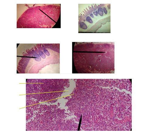 Lymphatic System Lab Diagram Quizlet