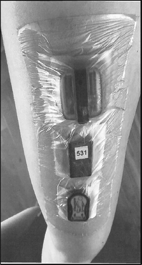 illustration of accelerometer placement top to bottom actigraph