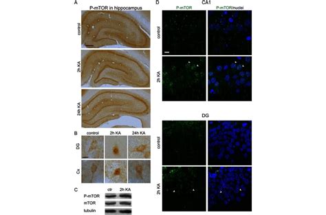 Anti Mtor Phospho Ser2448 Antibody A50181