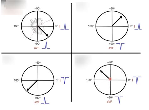 Diagram Of Mean Electrical Axis Mea Calculation Quizlet