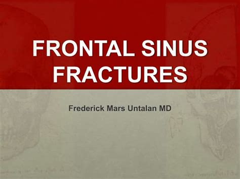 Radiological Anatomy Of Frontal Sinus Ppt