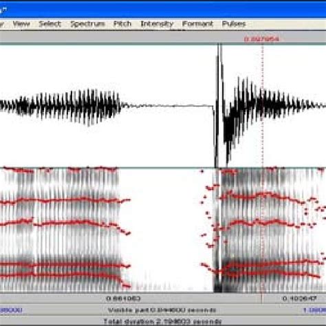Spectrogram With Formants Overlaid Of The Vowel Consonant Combination Download Scientific
