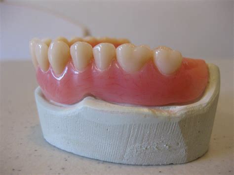 Superior Dental Laboratory Lucitone 199 Denture Base