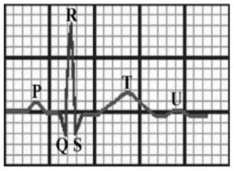 基于特征选取的st段分类卷积神经网络及其使用方法与流程2