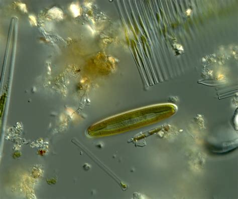 Diatoms – Croatian National Diatom Collection