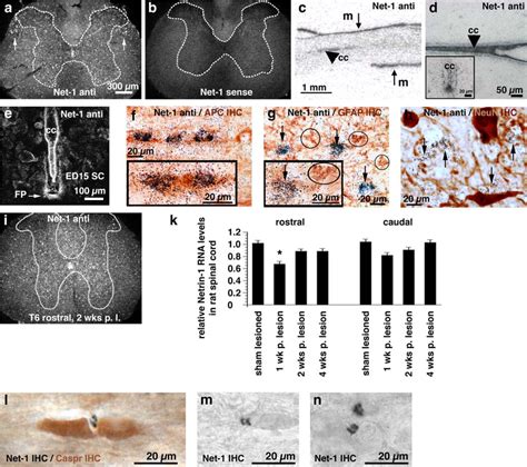 Netrin 1 Expression In Vivo A I In Situ Hybridization Was Performed Download Scientific