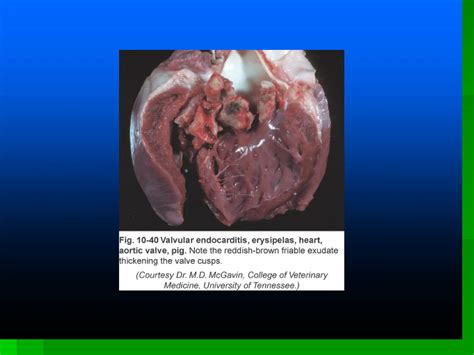 Patologi Cardiovascular Patologi Isstem Cardio Ppt