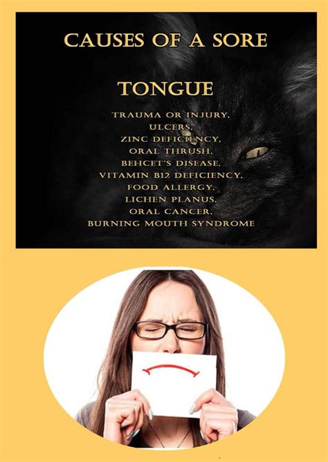 Buy Causes Of A Sore Tongue Trauma Or Injury Ulcers Zinc Deficiency Oral Thrush Behcets