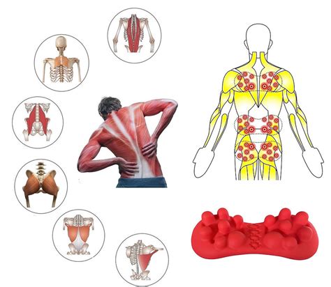 Understanding Hip Pain The Role Of Muscle Trigger Points
