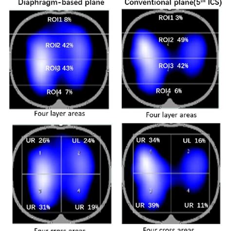 Difference Of Lung Ventilation Image In A Diaphragm Based Eit Belt Download Scientific Diagram