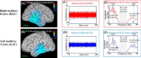Figure 2 From The Full Informational Spectral Analysis For Auditory Steady State Responses In