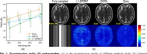 A Plug And Play Synthetic Data Deep Learning For Undersampled Magnetic Resonance Image