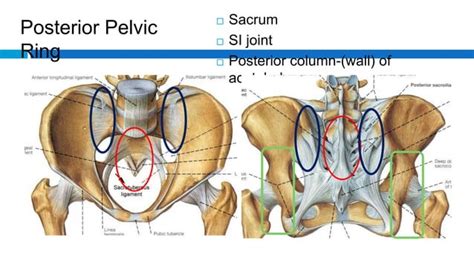 Posterior Pelvic Ring Injury Ppt