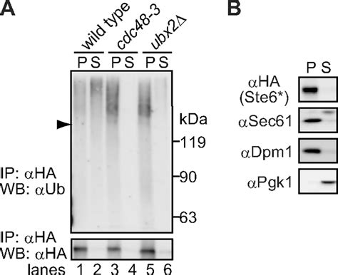 Subcellular Fractionation Assay Reveals That The Extraction Of