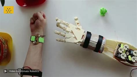 richard hulskes on linkedin robotic arm control with umyo emg sensors