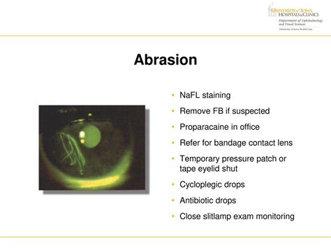 The Primary Care Eye Exam Evaluation Of The Acute Red Eye Ppt Download