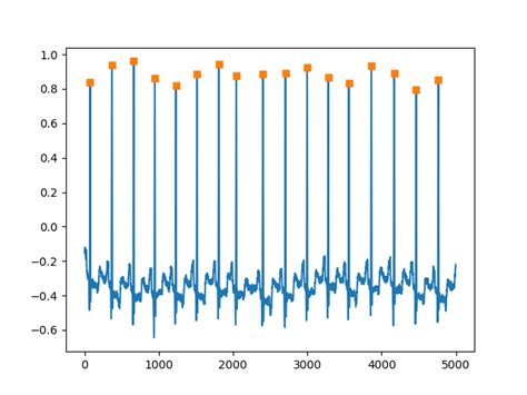 Algorithms A Real World Example Qrs Detection — Tpcp 0261 Documentation