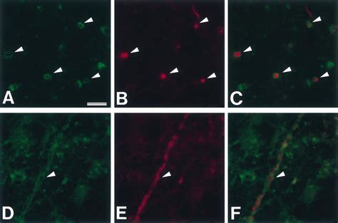 Cellular Localization Of P38 Immunoreactivity Sections Were