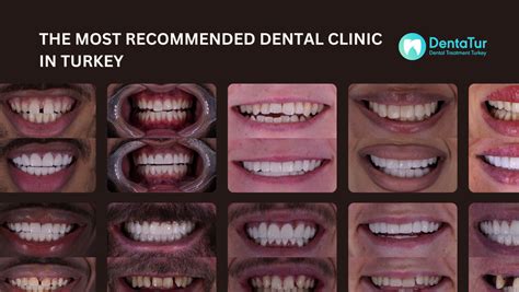 Quadrant Dental Quadrant Dental Technologies