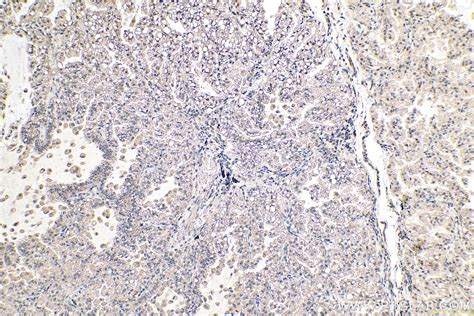 IHCeasy LOX Ready To Use IHC Kit KHC0630 Proteintech