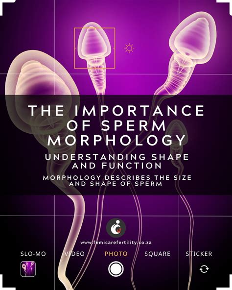 Sperm Morphology Refers To The Femicare Fertility Clinic Facebook