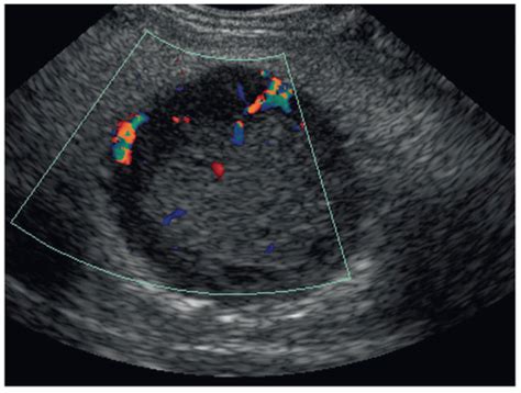 The Pancreas Radiology Key