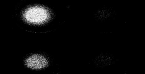 assembled image of processed dynamic laser speckle patterns with