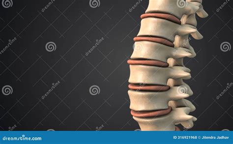 Difficulties With The Human Spinal Discs Stock Illustration Illustration Of Inflammation
