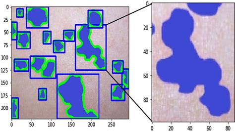 Contour Finding Algorithm Applied To Output Of U Net Clusters Of Download Scientific Diagram