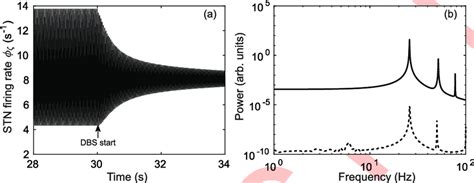 Suppression Of Parkinsonian Beta Activity For A 150 Hz External Download Scientific Diagram