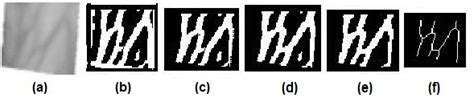 Different Steps Of The Vein Pattern Extraction From Froi A Extracted