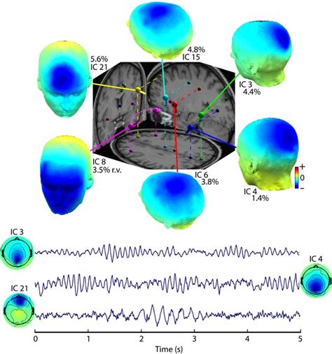 6 Equivalent Dipoles For Six Maximally Independent Brain Source Download Scientific Diagram