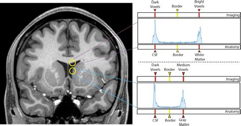 Frontiers Anatomically Curated Segmentation Of Human Subcortical Structures In High Resolution